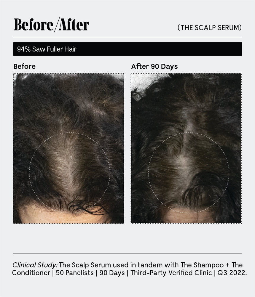 The Scalp Serum | 30-Day Supply | 1% Hyaluronic Acid – Nécessaire, A ...